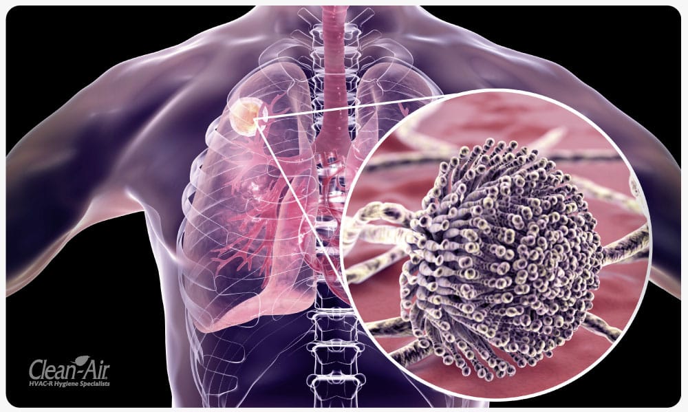 Microbe of the Month: Aspergillus – Clean-Air – Breathe-Easy™